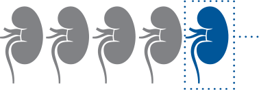 Acute Kidney Transplant Rejection Treatment